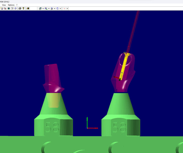 Angulated Screw Channel Custom Abutment Milling on Prefabricated Blank ...