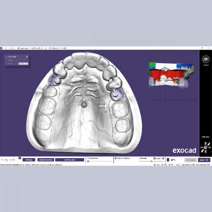 Exocad Stand Alone - Partial CAD Module – CM MEDICAL - Digital ...